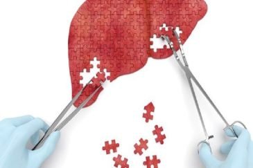 Acute Liver Failure - Neurospine Hospital & Revive Critical Care